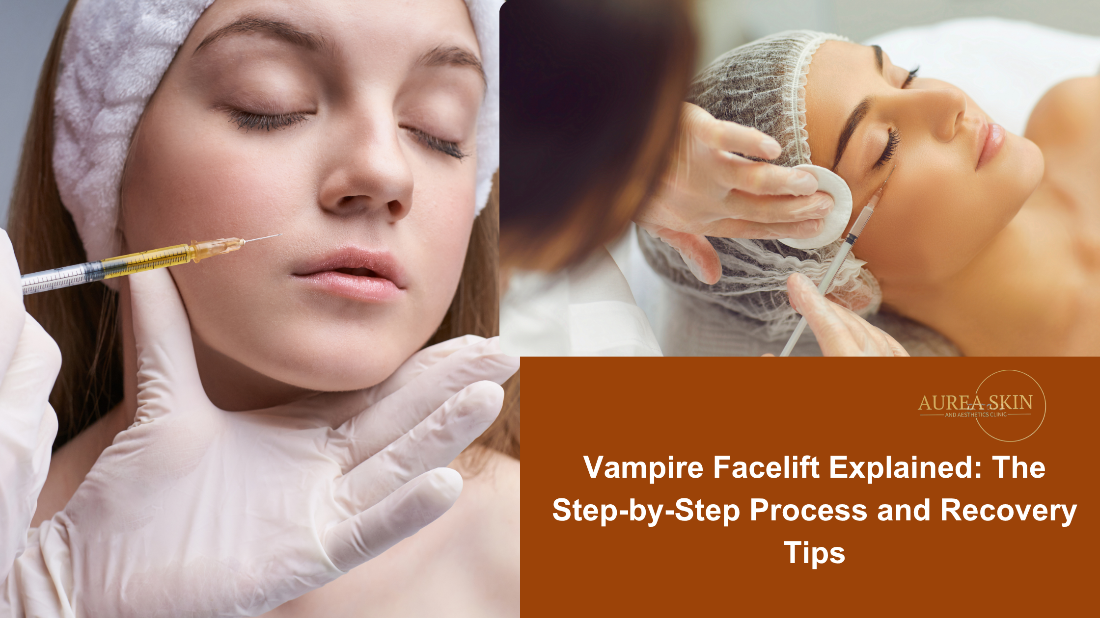 Vampire Facelift Explained: The Step-by-Step Process and Recovery Tips ...